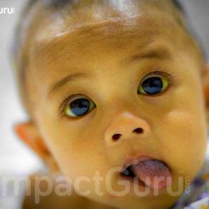Help a Baby With Biliary Atresia Get Liver Transplant - DonationCentral.org